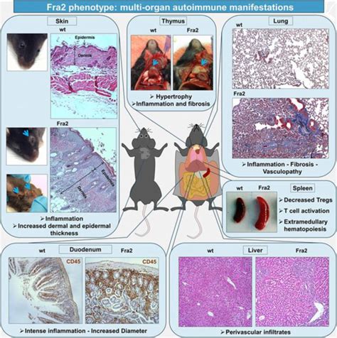 Op0206 Fra2 Is Playing A Key Role In The Control Of Treg Development And Autoimmunity Annals