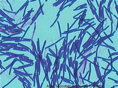 Gender Differences In Autoimmune Diseases Blame Them On Bacteria