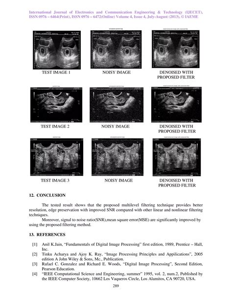 Speckle Noise Reduction From Medical Ultrasound Images Using Wavelet Thresh Pdf