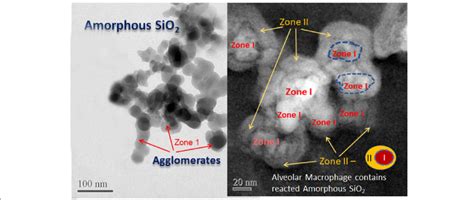 Bioprocessing Of Inhaled Nano Sio 2 Particles Left Large Download Scientific Diagram