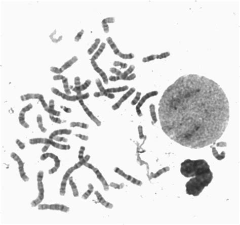 Chromosomal Abnormalities Object Detection Dataset And Pre Trained