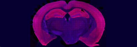 Mapping Fmri Networks In The Awake Mouse Bruker