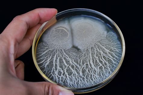 Bacillus Subtilis On Tsa My XXX Hot Girl