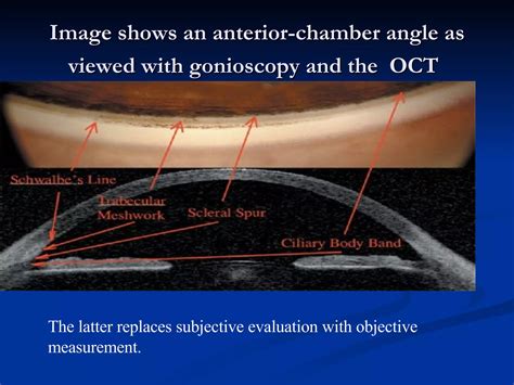 Optical Coherence Tomography Principle And Uses In Ophthalmology Ppt