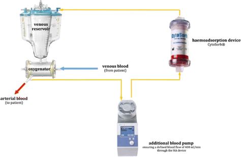 Cardiopulmonary Bypass Diagram