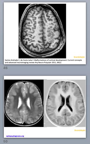 Neocortex Brain Bit By Bit