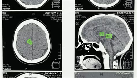 Medical Image Annotation And Labeling Services For Ai And Ml