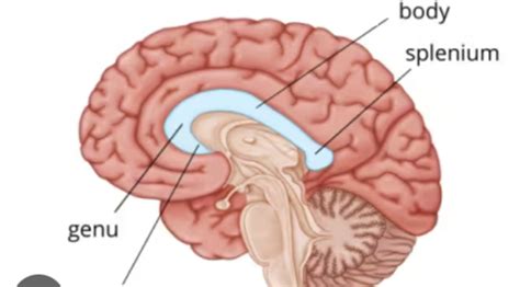 Bellringer Midsaggital Section And Ventricles Flashcards Quizlet