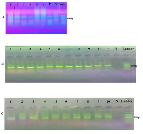 Agarose Gel Electrophoresis Of Pcr Of The 16srrna Gene A Nested Pcr Download Scientific