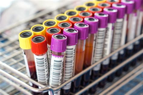 Vasculitis Prime Med Labs