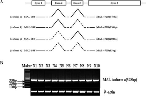 Identification Of MAL Gene Splicing Isoforms In Oral Squamous Download Scientific Diagram