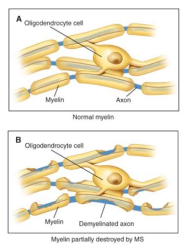 Chapter 14 Nervous Tissue Flashcards Quizlet