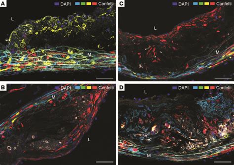 Jci Insight Diverse Cellular Architecture Of Atherosclerotic Plaque