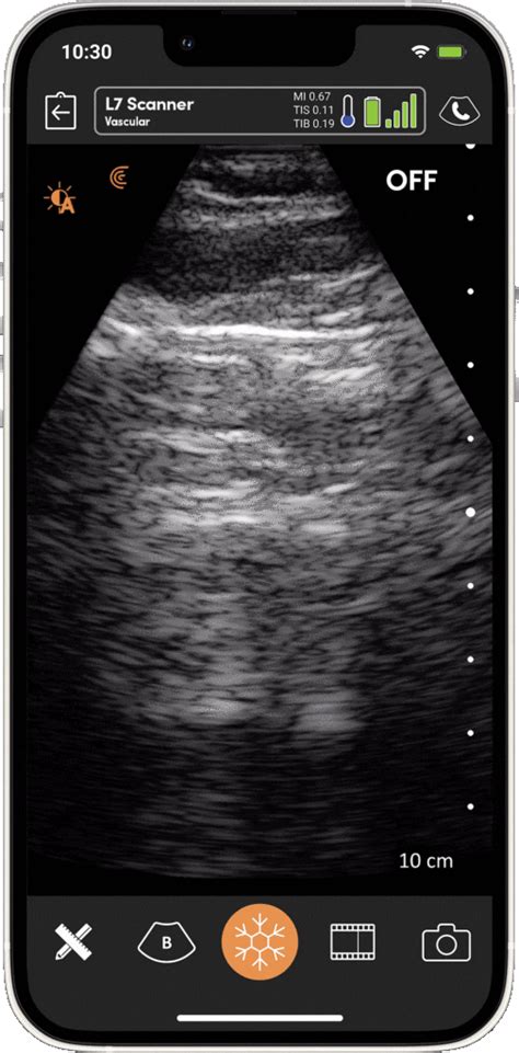 Personalize Your Imaging Experience With Clarius Ultrasound App 9