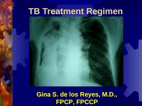 Ppt Tb Treatment Regimen Gina S De Los Reyes M D Fpcp Fpccp
