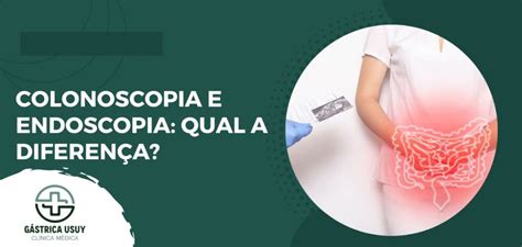 Colonoscopia E Endoscopia Qual A Diferença