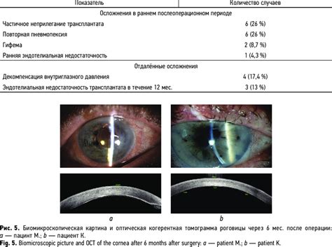 Early And Late Complications In The Postoperative Period Download