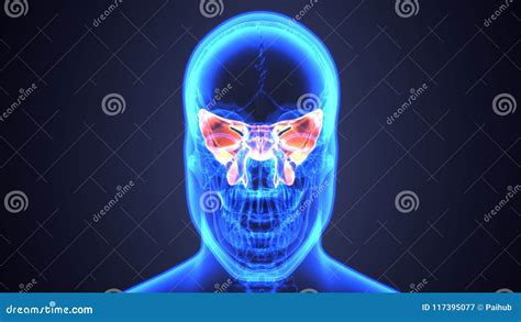 Sinusitis Of Human Skull With Inflamed At Sinus 3d Illustration