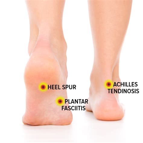 Conditions And Treatments — Kore Pedorthics