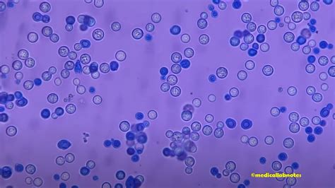 Lactophenol Cotton Blue Lpcb Stain Introduction Principle Test