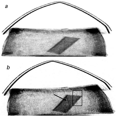 Materials Special Issue X Ray Imaging In Materials Science