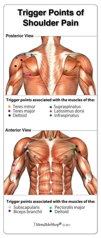 Deltoid Strain Symptoms Deltoid Strain Symptoms