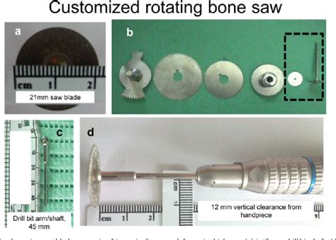 Figure 1 From Beveled Osteotomies In Lateral Orbitotomy Using A