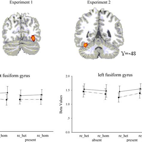 The Brain Activations Related To Processing Task‐irrelevant Download Scientific Diagram