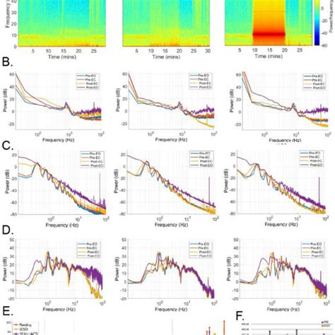 A Eeg Spectrogram Computed For F7 B Spectral Content Of Pre Eo Ec Download Scientific