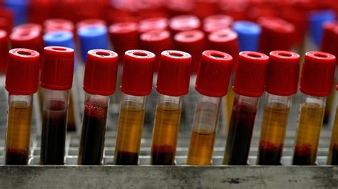 Akraba Akbaba Diyen Kan Grubu Belli Oldu Ne Düğün Ne Cenaze Hiçbiriyle İşleri Olmuyor