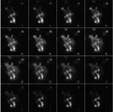 C Confocal Microscopic Analysis By Laser And Z Stack Method Download Scientific Diagram