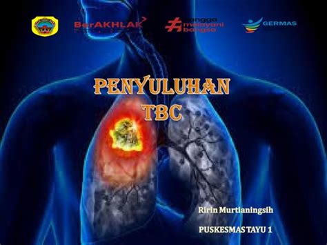 Power Point Tuberculosis Tayu 1 Versi Ppt