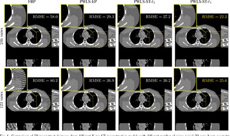 Sparse View X Ray Ct Reconstruction Using Ell1 Prior With Learned Transform