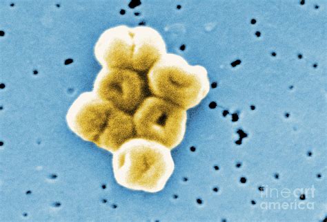Acinetobacter Baumannii Sem Photograph By Science Source Pixels