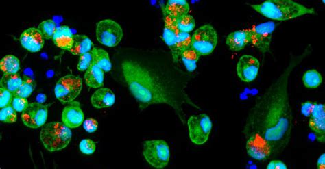 R2g Microglia Phagocytosis Assay Services