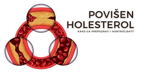 Povišen Holesterol Uzroci Simptomi I Efikasni Načini Lečenja
