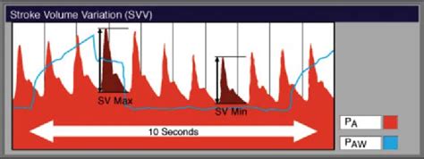 Figure 1 From Arterial Pressure And Stroke Volume Variability As