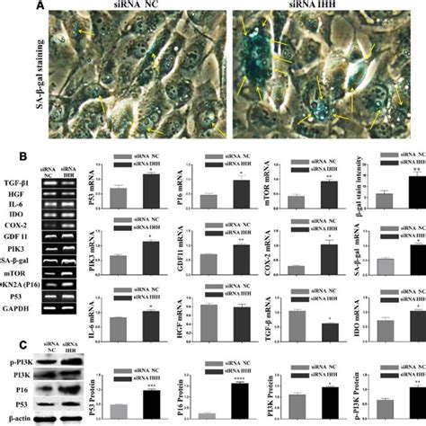 Skewed Differentiation Was Induced In Ihh Depleted Bmsc Aa B C