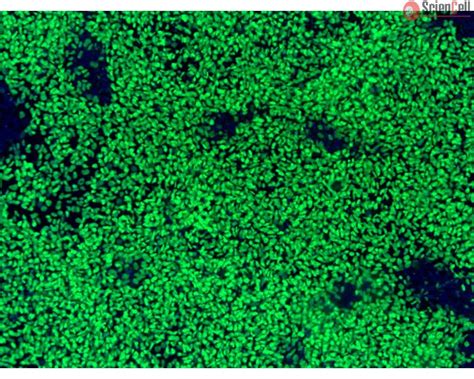 Human Pluripotent Stem Cell Derived Neural Crest Cells