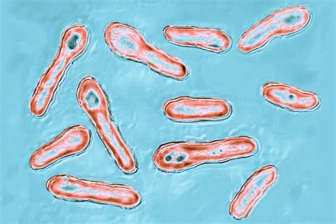 Botulism Discovery Of A New Source Of Worlds Deadliest Toxin