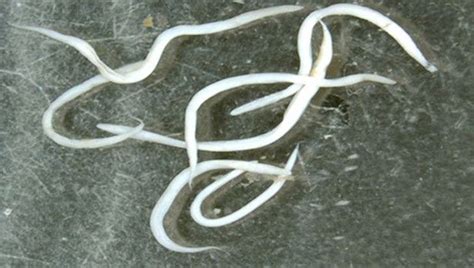 Что такое глисты и глистная инвазия как с ними бороться чем опасны для ребенка признаки