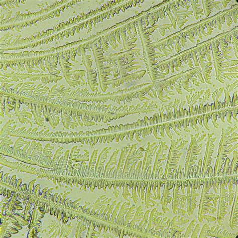 Fern Test Overview Appearance And Clinical Significance