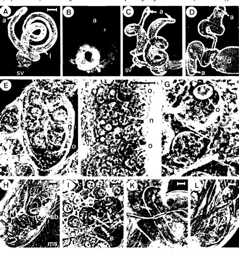 Figure 2 From Sex Determination In The Germ Line Of Drosophila Depends On Genetic Signals And