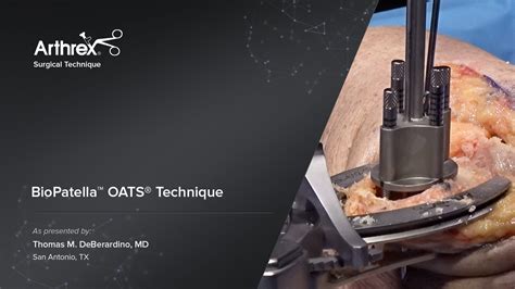 Arthrex Biopatella™ Oats® Instrument Set