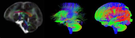 The Developing Human Connectome Project Announces Its First Open Access