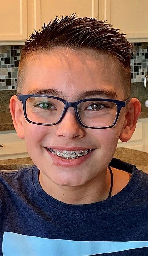 Pin By Bruce Nicolosi On Adult Braces Glasses Fashion Adult Braces