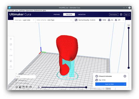 3d Printed Toe Splint