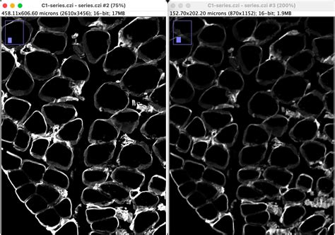 Incorrect Pixel Scaling On Czi Image Series Usage And Issues Imagesc Forum