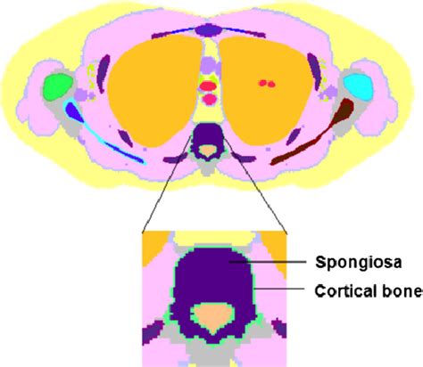 Mash Voxelized Phantom Segmentation Of Spongiosa And Cortical Bone Download Scientific Diagram