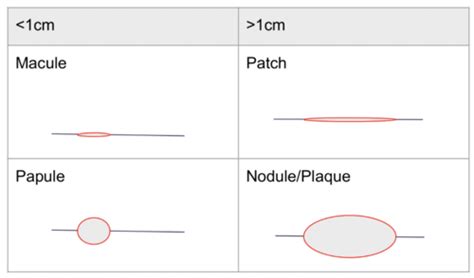 Dermatology Flashcards Quizlet